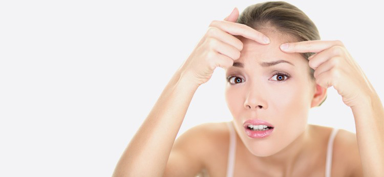 ¿Acné o imperfecciones en el rostro? ¡Tiene solución! - Humildad Ruiz